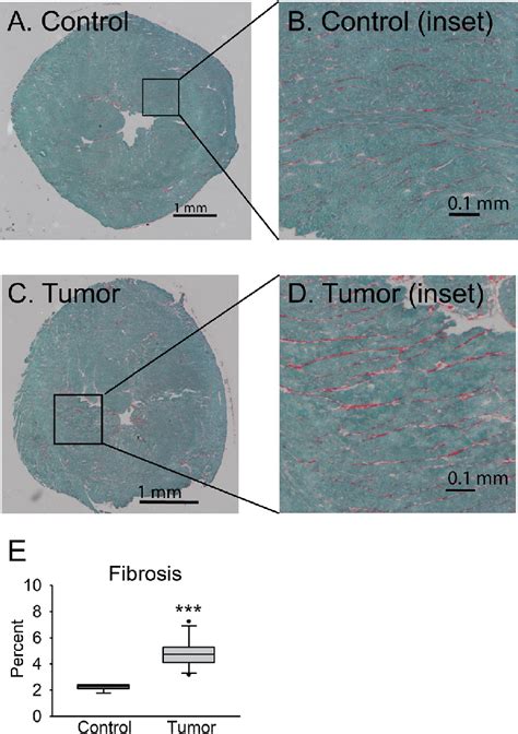 Fibrosis Development Fibrotic Area Was Measured In Sirius Redfast Download Scientific Diagram