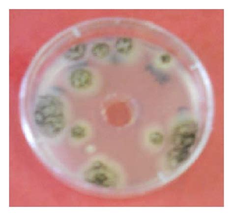 Visualization Of The Inhibition Zones In The Plate Diffusion Test For