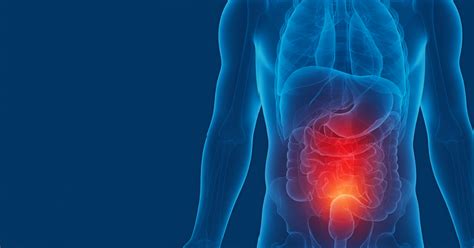 Is It Possible To Prevent Prostate Cancer What Are The Risk Factors
