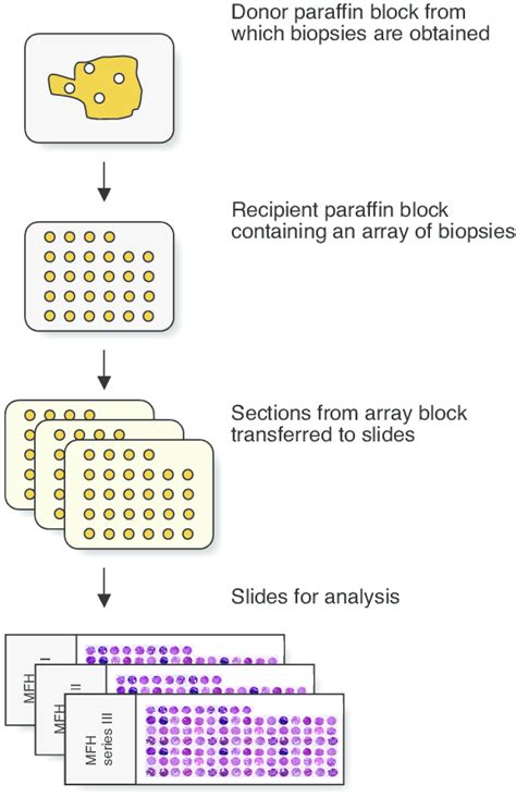 schematic presentation of the tissue microarray method download scientific diagram