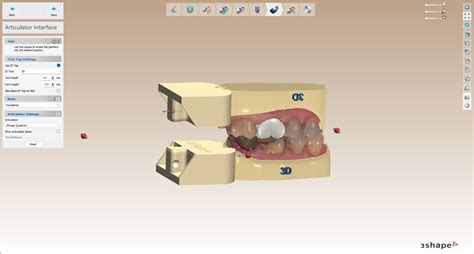 🩻 Digital Quadrant Model With 3shape Articulator Interfaces・ Stl File For 3d Printing And Cnc