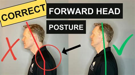 Correct Forward Head Posture Best Exercise Youtube