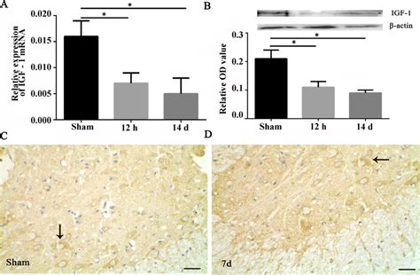 The Expression Of Igf‐1 In The Spinal Cord Of Rats With Hsci A B Download Scientific