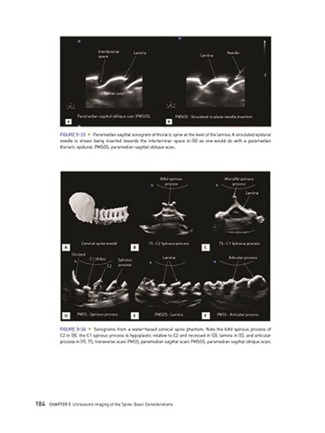 알라딘 미리보기 통증의학을 위한 근골격계 초음파 해부학