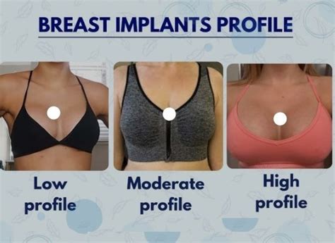 High Vs Moderate Profile Breast Implants Cost In Turkey