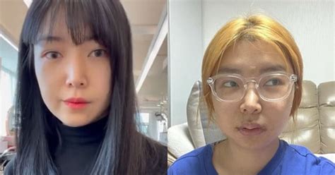 나는 솔로 10기 영자 외모 얘기에 타격…양악수술은 인생 전환점 [종합]