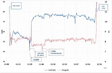 Figure 1 From Cardiopulmonary Bypass Graft In A Post Covi 19 Thalassemic Patient Semantic Scholar