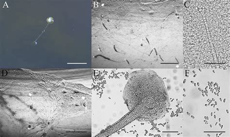 Dictyostelium Under Microscope