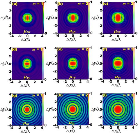 Tight Focusing Of Circular Partially Coherent Radially Polarized Circular Airy Vortex Beam