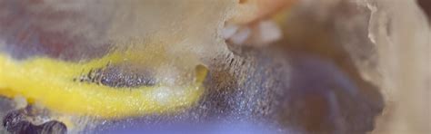 Voxel Man 3d Printing 3d Printing In Virtual Surgery