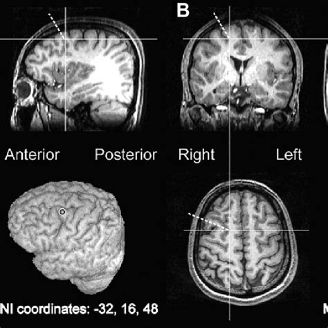 The Targeted Location Over The Frontal Eye Field In The Left A Or