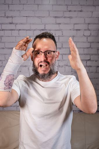 안경을 쓴 남자는 아이들의 그림과 흰색 티셔츠가 있는 부목으로 부러진 팔을 보여줍니다 40 44세에 대한 스톡 사진 및 기타 이미지 40 44세 Centers For