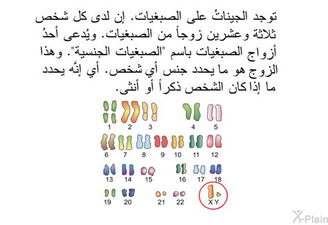 متلازمة كلاينفلتر