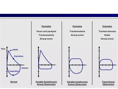 Interpretation Of Pulmonary Function Test PPTX Lung And Respiratory Health Diseases And