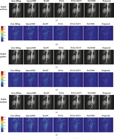 Figure 1 From Compressed Sensing Mri Reconstruction With Multiple