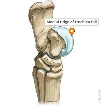 Medial Ridge Of Trochlea Tali Vet Anatomy Imaios