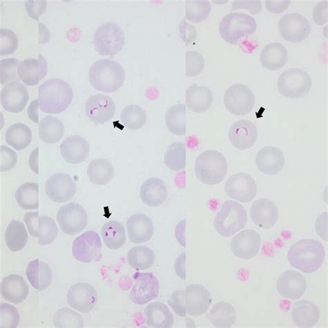 Heat Map Constructed Using The Pairwise Distance Matrix Based On Download Scientific Diagram