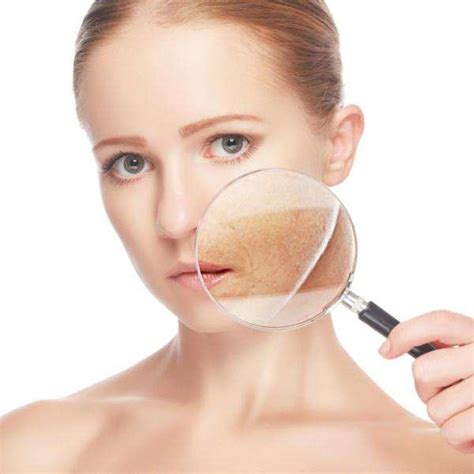 Cómo Quitar Las Manchas De La Cara Del Sol Gastropatios