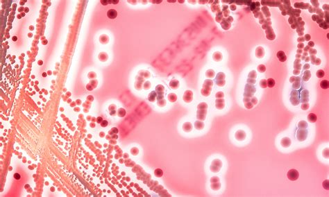 Roadmap To Incorporating Group A Streptococcus Molecular Point‐of‐care