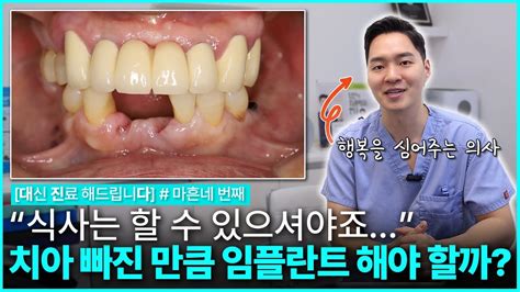 대진다 음식을 씹는 행복이 얼마 만인지│당일 임플란트 당일 임시치아 임플란트 뼈이식 앞니 임플란트 어금니 임플란트│마흔네 번째 Youtube