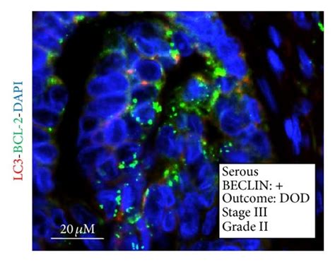 Immunofluorescence Staining Of Lc3 And Bcl 2 Selection Of