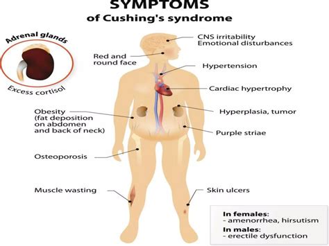Endocrine Diseasespptx