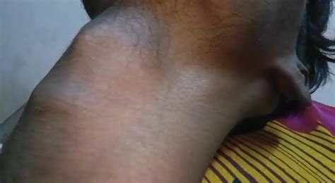 Adams Apple Video 176