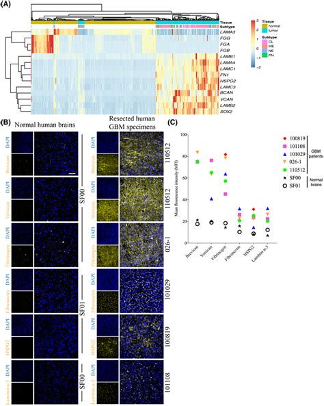 Expression Of Extracellular Matrix Molecules In The Tumor Download Scientific Diagram