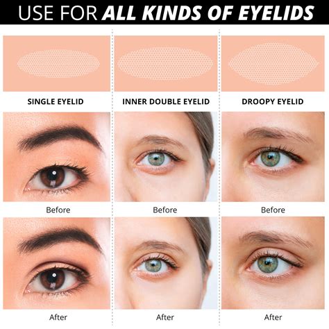 Milakos Eyelid Tape 660 Pairs Double Eyelid Tape For