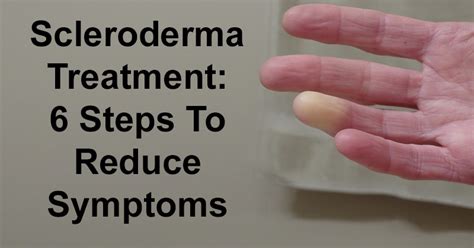 Scleroderma Treatment 6 Steps To Reduce Symptoms David Avocado Wolfe