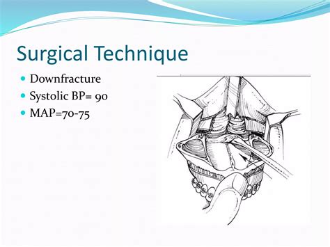 Maxillary Surgery Ppt