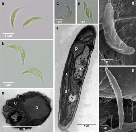 Light Scanning And Transmission Electron Micrographs Of The Strains A Download Scientific