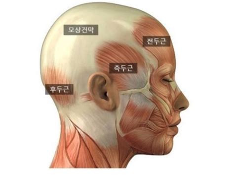 긴장성 두통 두피 근육 수축 근막 통각수용기의 민감화 근육 긴장성 두통tension Type Headache 편두통 비교 긴장성 두통 두피 근육 수축 근막 통각수용기의 민감화 근육 긴장성 두통tension Type Headache 편두통 비교