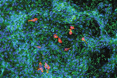 Weill Cornell Researchers Identify A Key Human Gene That Enables Sars