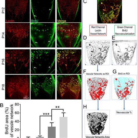 Detection Of Brdu Labeled Neovasculature In The Oir Mouse Retina A