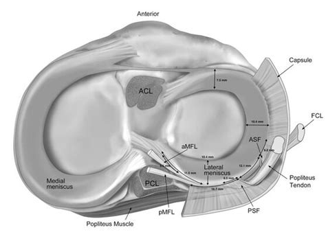 Hypermobile Meniscus Physiopedia