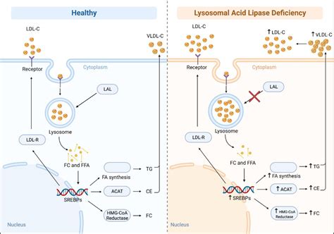 Distinguishing Lysosomal Acid Lipase Deficiency From Familial