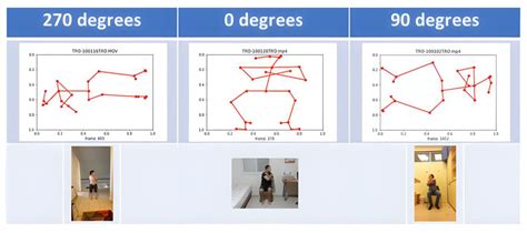 Jpm Free Full Text Using Efficientnet B7 Cnn Variational Auto