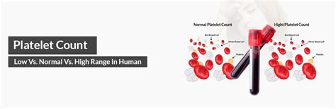 Platelet Count Low Vs Normal Vs High Range In Human