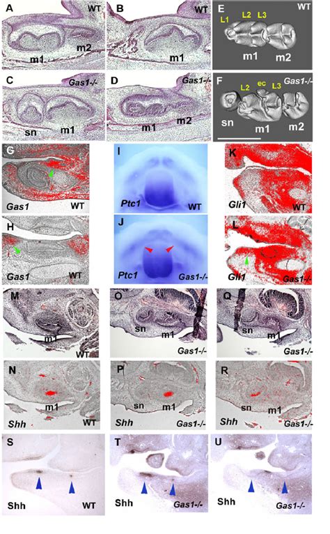 Molar Tooth Phenotypes Of Gas1 Mutant Mice A F Sagittal Sections