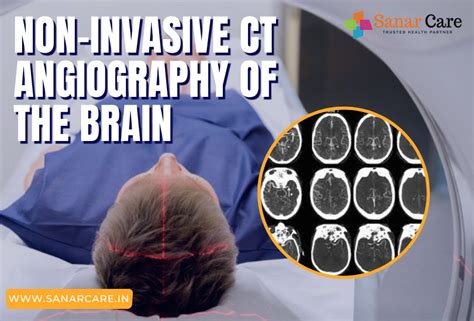 Non Invasive CT Angiography Of The Brain In Gurgaon Sanar