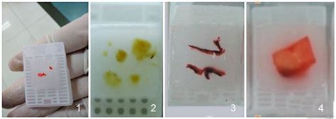The Latest Express Of Tissue Block Paraffin Embedding Technology