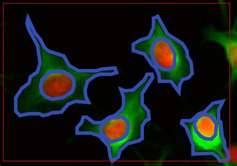 Combining Cellpose And Stardist Detections Into Cells Image Analysis Imagesc Forum