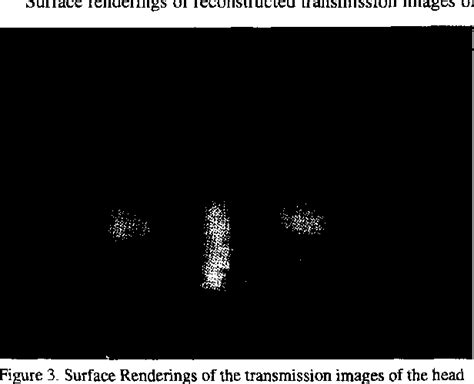 Figure 1 From Model Based Scatter Correction For Fully 3d Pet
