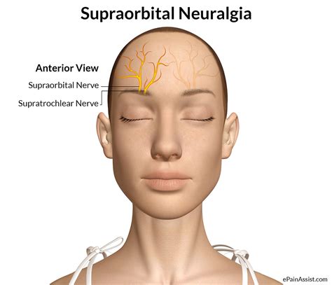 Supratrochlear Nerve Nose Anesthesia