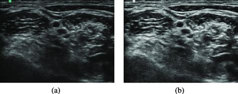 Example Of An Enhanced Image Using Limiting Contrast Adaptive Histogram Download Scientific