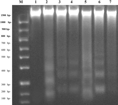 Brain Dna Fragmentation Pattern Analyzed By Dna Gel Electrophoresis