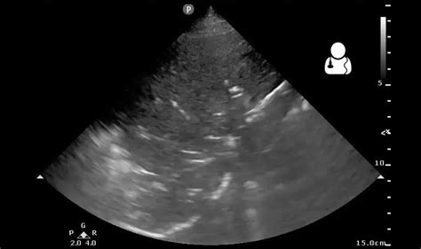 Uotw 34 Core Ultrasound