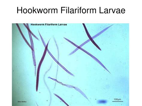 Ppt Roundworms Powerpoint Presentation Free Download Id1745236