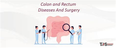 Colon And Rectum Diseases And Surgery Turkish Bariatric Surgery